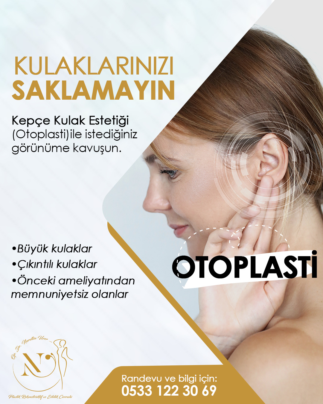 Kepçe Kulak Ameliyatı (Otoplasti) Nedir? - Op. Dr. Nurettin Uzer
